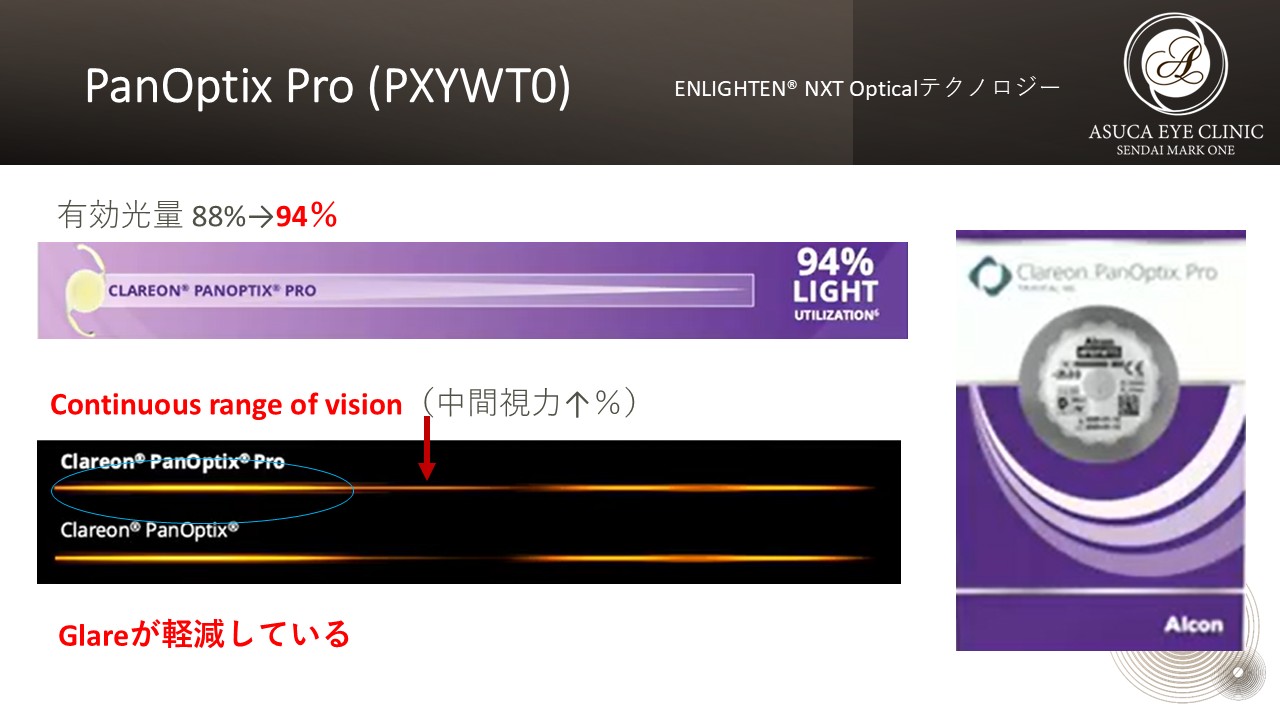 Alcon「Clareon PanOptix Pro」新商品説明会が行われました(糸満院) | 医療法人水晶会安里眼科